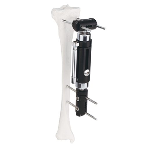 Hip Joint Traction External Fixator - Orthopromed Inc. Medical