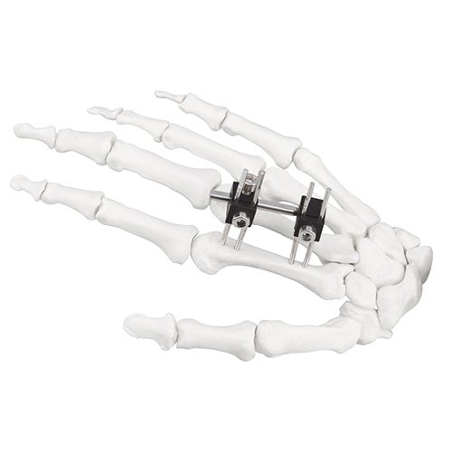 Mini Fragment External Fixator (Finger and Palm) - Orthopromed Inc. Medical